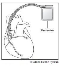 Heart failure | Other treatments