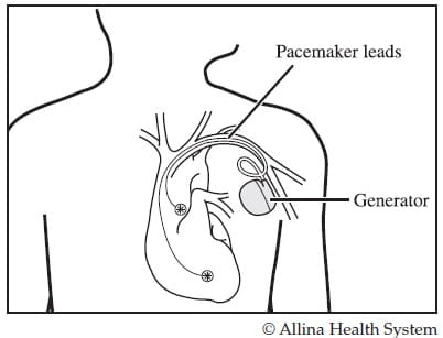 Heart tests and procedures